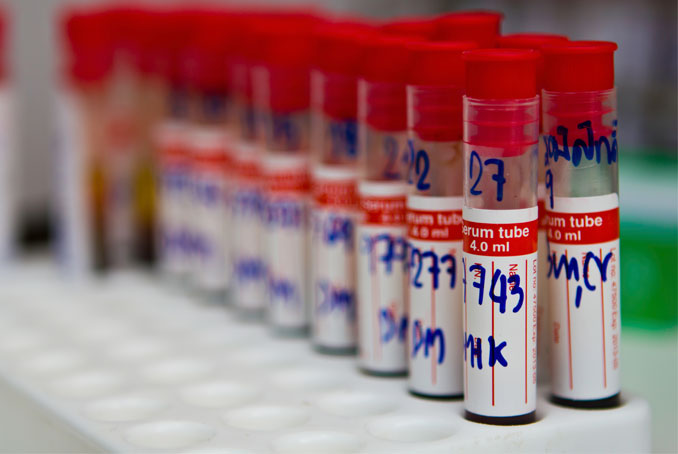 Hémovigilance et sécurité transfusionnelle | Agence régionale de santé PACA