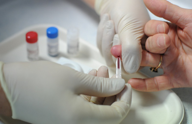 Test rapide d’orientation diagnostic pour le VIH et l’Hépatite C ...